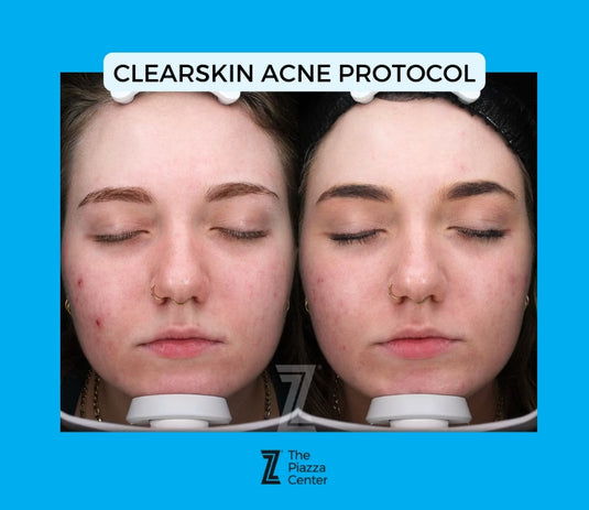 Advanced Skincare & Biohacking | Piazza Center – The Piazza Center for ...